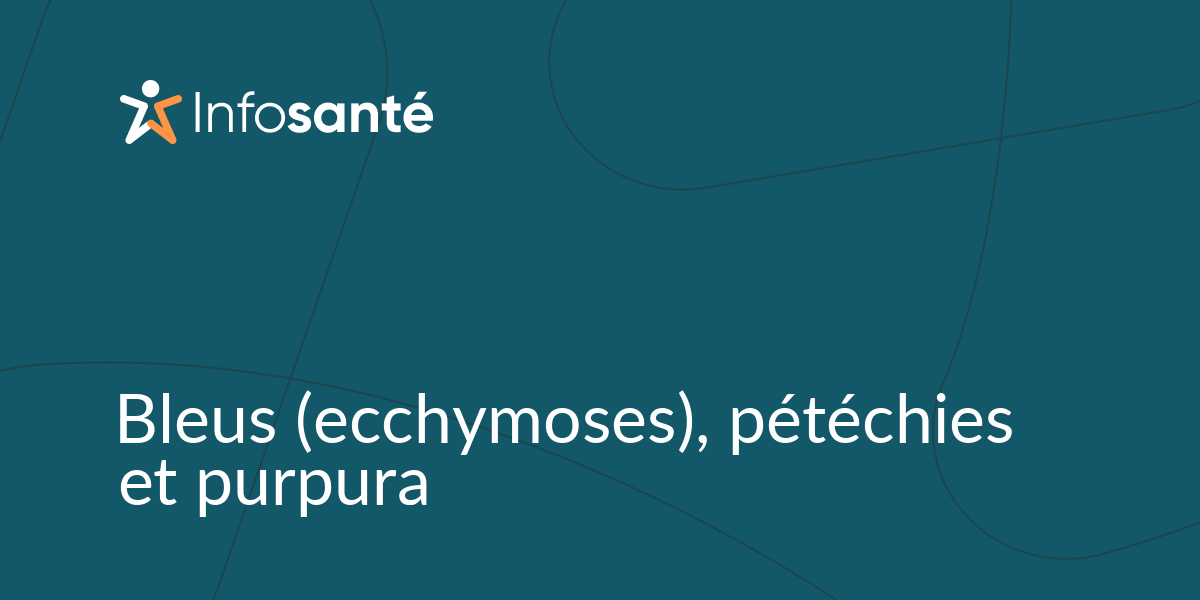 Bleus (ecchymoses), pétéchies et purpura • Infosanté